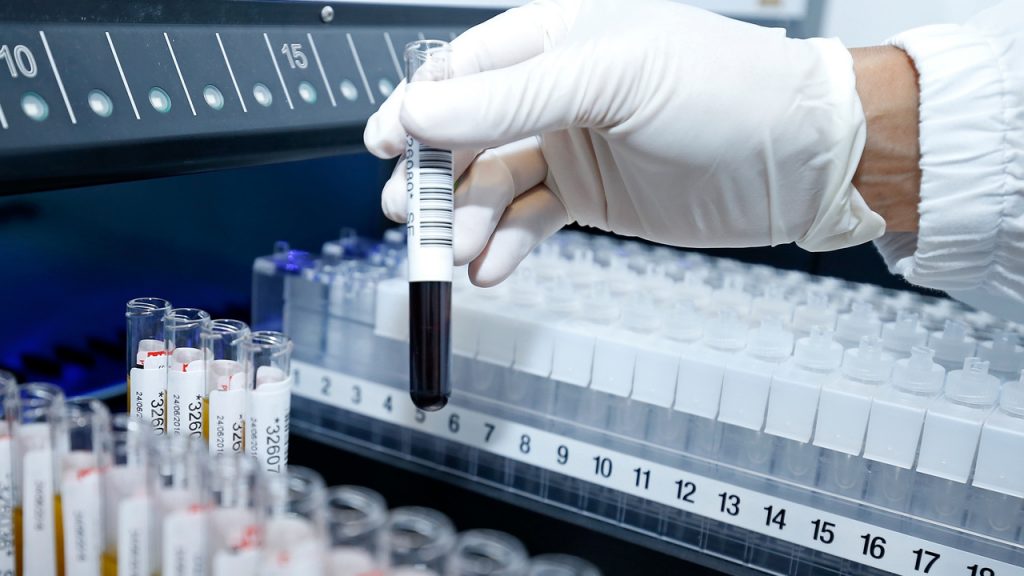 26 Novel Coronavirus Infection Research Projects being funded by the ...